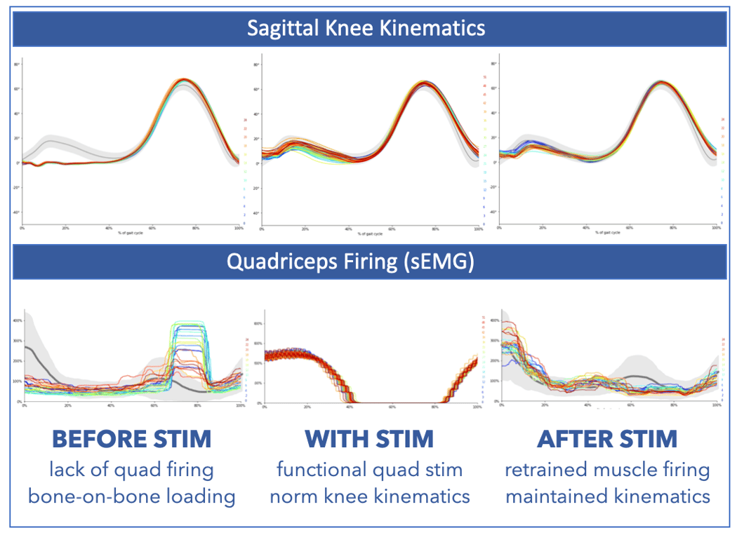 Case Study Quad Avoidance
